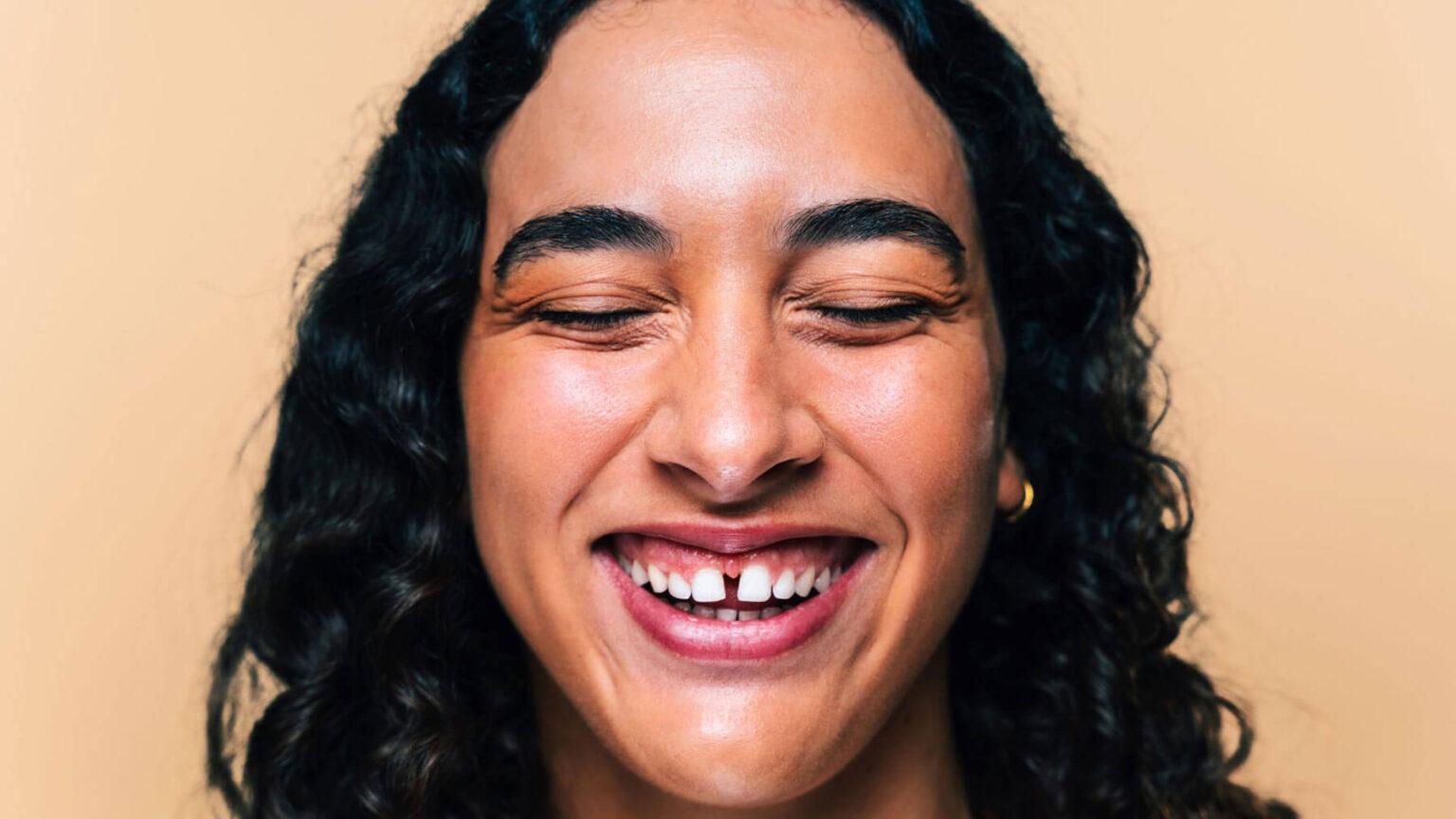 Are Gaps in Your Teeth Bad? | Dental Gap Risks and Long Term